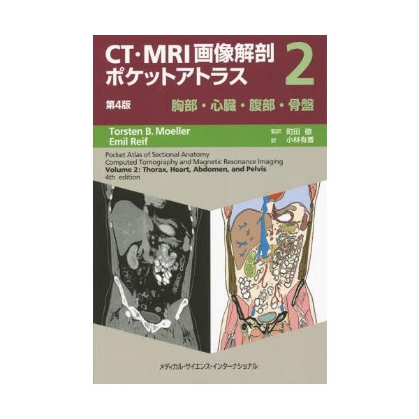 【発売日：2015年01月28日】トルステンB.メーラー/著 エミールレイフ/著 町田徹/監訳/CT・MRI画像解剖ポケットアトラス 2 / 原タイトル:Pocket Atlas of Sectional Anatomy.Volume2:T...