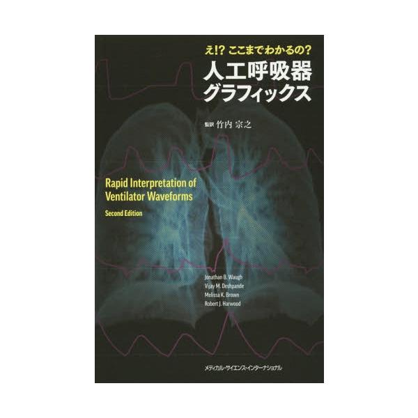 【発売日：2015年05月28日】竹内宗之/監訳 ジョナサンB.ウォー/著 ヴィジェイM.デシュパンデ/著 メリッサK.ブラウン/著 ロバートJ.ハーウッド/著/え!?ここまでわかるの?人工呼吸器グラフィックス / 原タイトル:RAPID ...