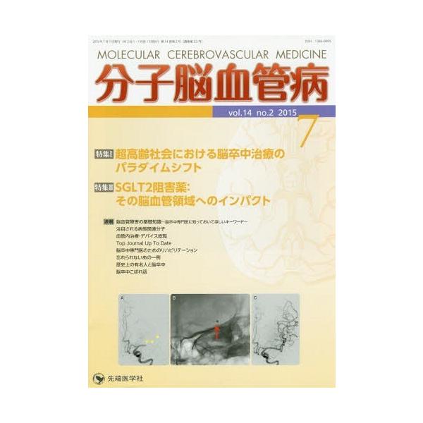 【発売日：2015年07月28日】「分子脳血管病」編集委員会/編集/分子脳血管病 vol.14no.2(2015-7)、メディア：BOOK、発売日：2015/07、重量：340g、商品コード：NEOBK-1835557、JANコード/ISB...
