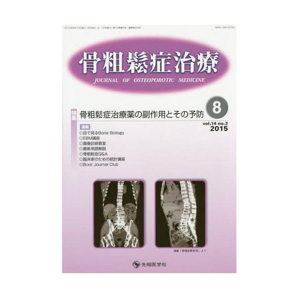 【発売日：2015年08月28日】「骨粗鬆症治療」編集委員会/編集/骨粗鬆症治療 vol.14no.2(2015-4)、メディア：BOOK、発売日：2015/08、重量：340g、商品コード：NEOBK-1845434、JANコード/ISB...
