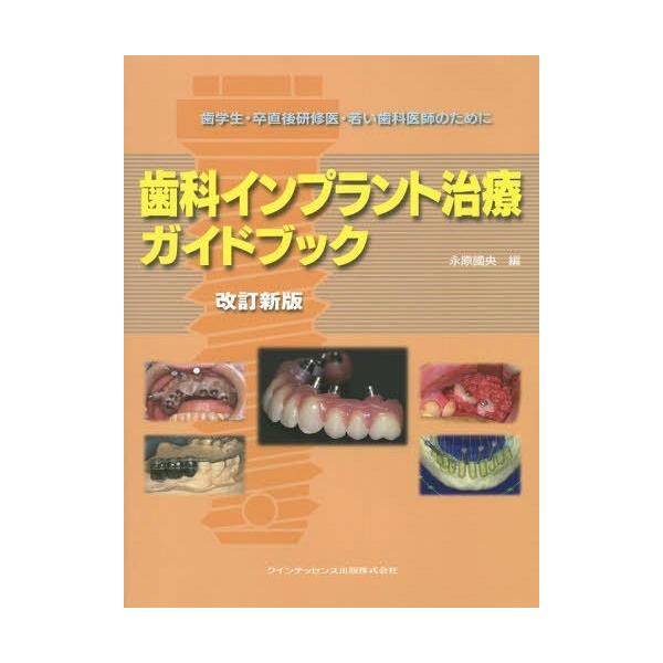 【発売日：2015年12月28日】永原國央/編/歯科インプラント治療ガイドブック 歯学生・卒直後研修医・若い歯科医師のために、メディア：BOOK、発売日：2015/12、重量：764g、商品コード：NEOBK-1893780、JANコード/...