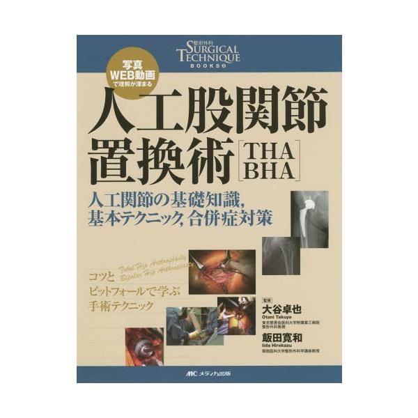 【発売日：2016年01月23日】大谷卓也/監修 飯田寛和/監修/人工股関節置換術〈THA・BHA〉 人工関節の基礎知識 基本テクニック 合併症対策 写真・WEB動画で理解が深まる (整形外科SURGICAL TECHNIQUE BOOKS...