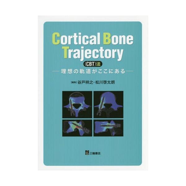 【発売日：2016年04月22日】谷戸祥之/編集 松川啓太朗/編集/Cortical Bone Trajectory〈CBT〉法 理想の軌道がここにある、メディア：BOOK、発売日：2016/04、重量：340g、商品コード：NEOBK-1...