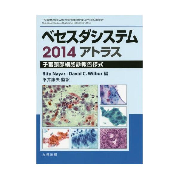 【発売日：2016年06月05日】RituNayar/編 DavidC.Wilbur/編 平井康夫/監訳/ベセスダシステム2014アトラス 子宮頸部細胞診報告様式 / 原タイトル:The Bethesda System for Report...