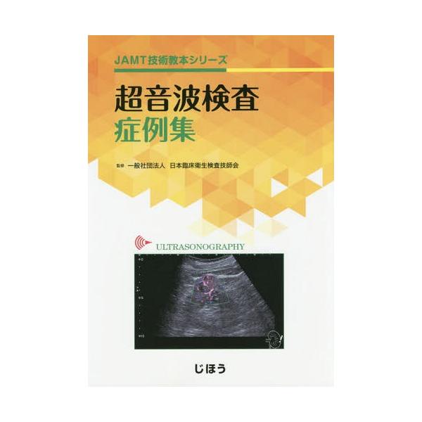 【発売日：2016年08月28日】日本臨床衛生検査技師会/監修/超音波検査症例集 CD付 (JAMT技術教本シリーズ)、メディア：BOOK、発売日：2016/08、重量：540g、商品コード：NEOBK-1995153、JANコード/ISB...