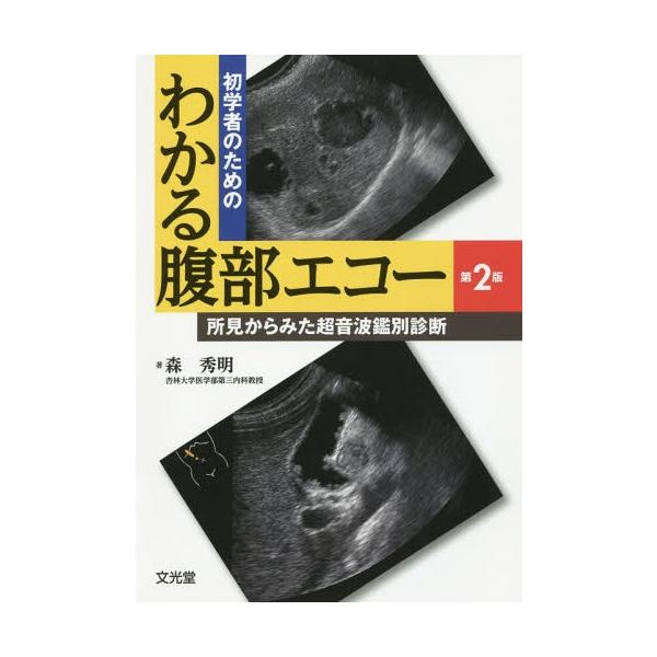 【発売日：2016年10月28日】森秀明/著/初学者のためのわかる腹部エコー 第2版、メディア：BOOK、発売日：2016/10、重量：340g、商品コード：NEOBK-2021726、JANコード/ISBNコード：9784830637513