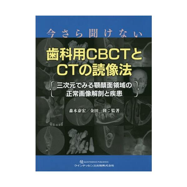 【発売日：2017年02月19日】森本泰宏/監著 金田隆/監著/今さら聞けない歯科用CBCTとCTの読像法 三次元でみる顎顔面領域の正常画像解剖と疾患、メディア：BOOK、発売日：2017/02、重量：340g、商品コード：NEOBK-20...