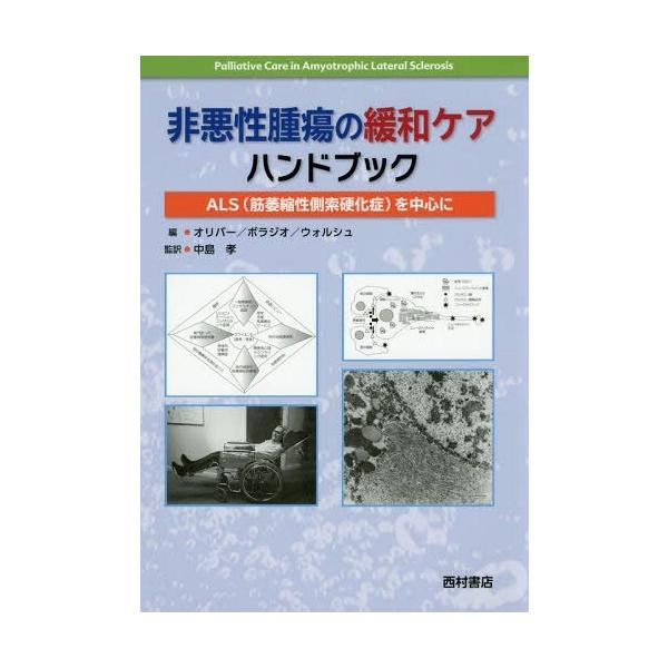 【発売日：2017年04月10日】D.オリバー/編 G.D.ボラジオ/編 D.ウォルシュ/編 中島孝/監訳/非悪性腫瘍の緩和ケアハンドブック ALS〈筋萎縮性側索硬化症〉を中心に / 原タイトル:Palliative Care in Amy...