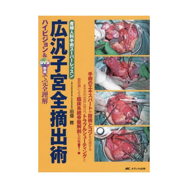 【発売日：2017年04月21日】田畑務/著/広汎子宮全摘出術 ハイビジョン&amp;DVD動画で完全理解 産婦人科手術スーパーレッスン、メディア：BOOK、発売日：2017/04、重量：654g、商品コード：NEOBK-2086057、J...