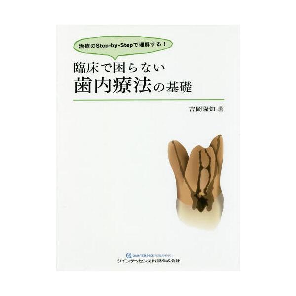 【発売日：2017年06月28日】吉岡隆知/著/臨床で困らない歯内療法の基礎 治療のStep‐by‐Stepで理解する!、メディア：BOOK、発売日：2017/06、重量：340g、商品コード：NEOBK-2103987、JANコード/IS...