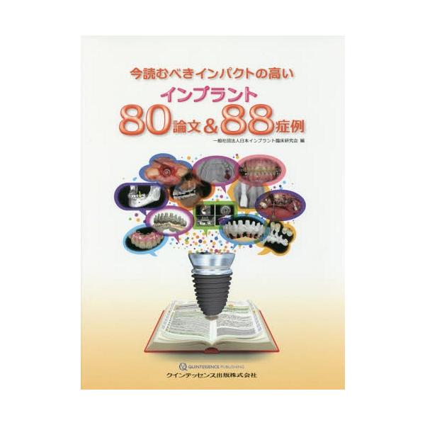 【発売日：2017年07月28日】日本インプラント臨床研究会/編/今読むべきインパクトの高いインプラント80論文&amp;88症例、メディア：BOOK、発売日：2017/07、重量：340g、商品コード：NEOBK-2114806、JANコ...