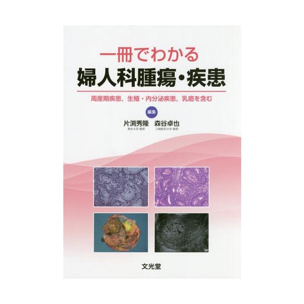 【発売日：2017年08月03日】片渕秀隆/編集 森谷卓也/編集/一冊でわかる婦人科腫瘍・疾患 周産期疾患、メディア：BOOK、発売日：2017/08、重量：529g、商品コード：NEOBK-2123811、JANコード/ISBNコード：9...