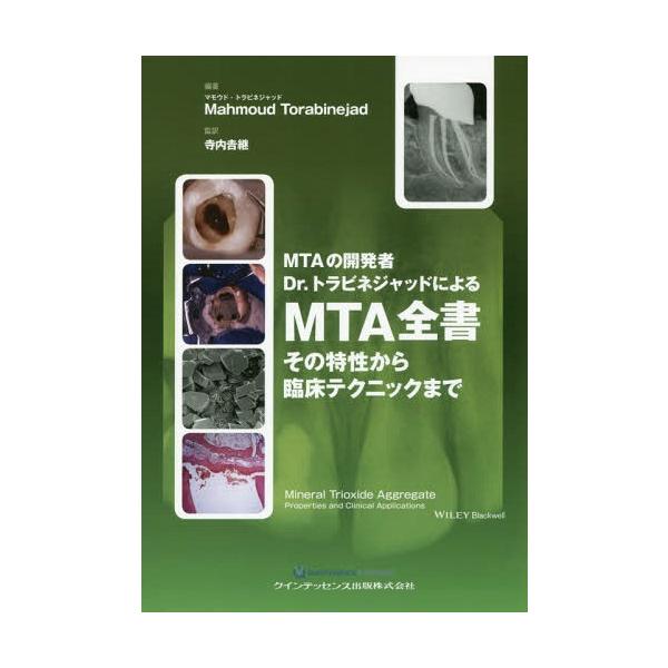 【発売日：2017年09月28日】MahmoudTorabinejad/編著 寺内吉継/監訳/MTA全書 その特性から臨床テクニックまで MTAの開発者Dr.トラビネジャッドによる / 原タイトル:Mineral Trioxide Aggr...