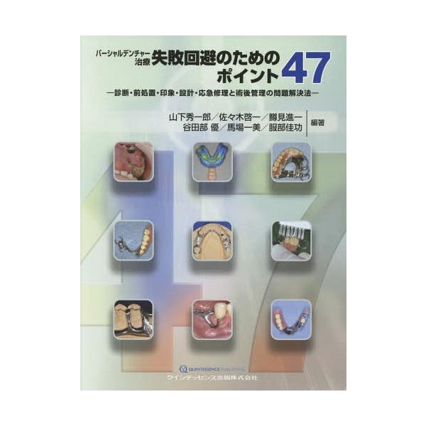 【発売日：2017年11月28日】山下秀一郎/編著 佐々木啓一/編著 鱒見進一/編著 谷田部優/編著 馬場一美/編著 服部佳功/編著/パーシャルデンチャー治療失敗回避のためのポイント47 診断・前処置・印象・設計・応急修理と術後管理の問題解...