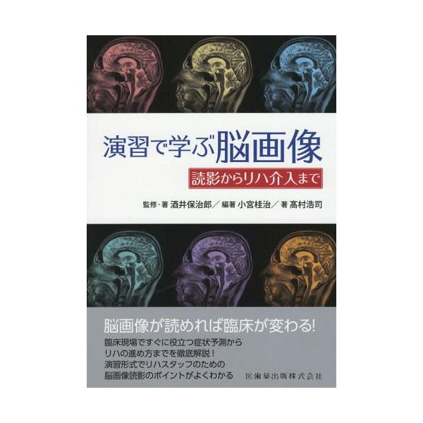 【発売日：2017年12月20日】小宮桂治/編著 酒井保治郎/監修・著 高村浩司/著/演習で学ぶ脳画像 読影からリハ介入まで、メディア：BOOK、発売日：2017/12、重量：340g、商品コード：NEOBK-2177852、JANコード/...