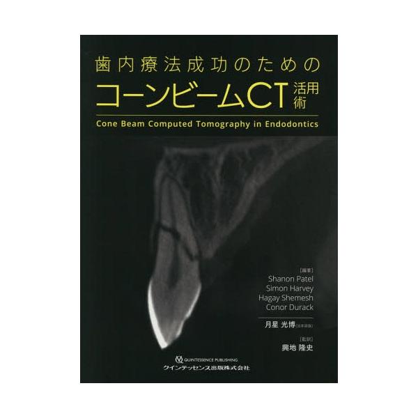 【発売日：2018年01月28日】ShanonPatel/編著 SimonHarvey/編著 HagayShemesh/編著 ConorDurack/編著 月星光博/編著 興地隆史/監訳/歯内療法成功のためのコーンビームCT活用術 / 原タ...