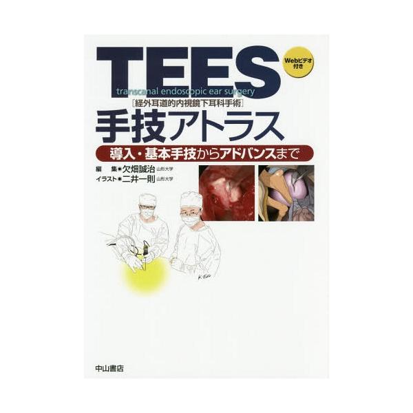 【発売日：2018年06月28日】欠畑誠治/編集 二井一則/イラスト/TEES〈経外耳道的内視鏡下耳科手術〉手技アトラス 導入・基本手技からアドバンスまで、メディア：BOOK、発売日：2018/06、重量：340g、商品コード：NEOBK-...