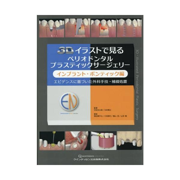 【発売日：2018年10月28日】中田光太郎/監著 木林博之/監著 岡田素平太/著 小田師巳/著 園山亘/著 山羽徹/著/3Dイラストで見るペリオドンタルプラスティックサージェリー インプラント・ポンティック編、メディア：BOOK、発売日：...