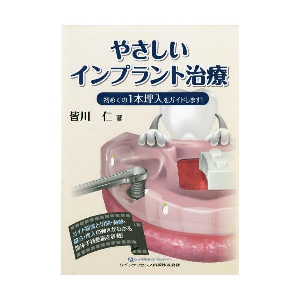 【発売日：2018年10月28日】皆川仁/著/やさしいインプラント治療 初めての1本埋入をガイドします!、メディア：BOOK、発売日：2018/10、重量：647g、商品コード：NEOBK-2284404、JANコード/ISBNコード：97...