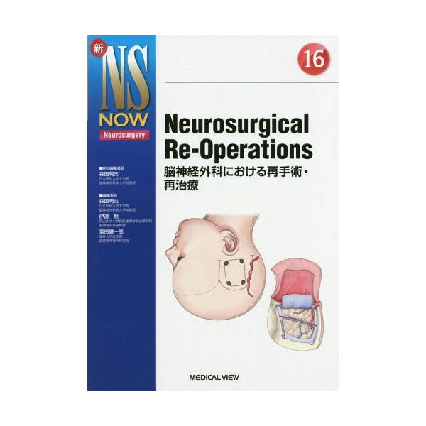 【発売日：2018年12月03日】森田明夫/担当編集委員/Neurosurgical Re‐Operations 脳神経外科における再手術・再治療 (新NS NOW Neurosurgery 16)、メディア：BOOK、発売日：2018/1...