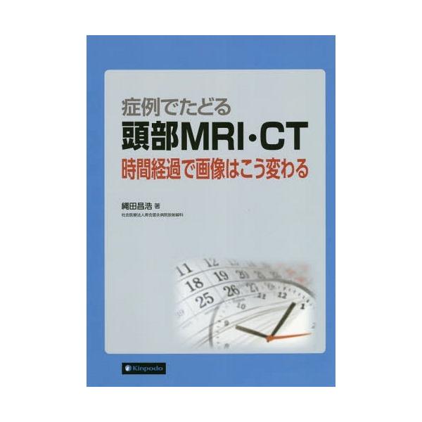 【発売日：2018年12月22日】縄田昌浩/著/症例でたどる頭部MRI・CT 時間経過で、メディア：BOOK、発売日：2018/12、重量：340g、商品コード：NEOBK-2314486、JANコード/ISBNコード：9784765317719