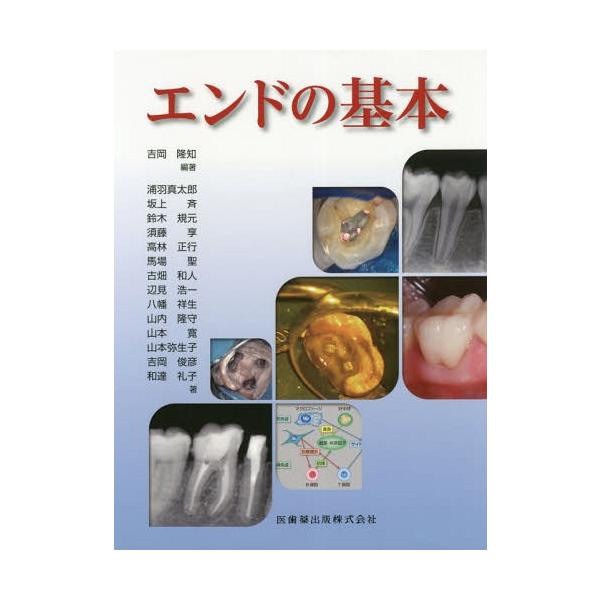 【発売日：2019年03月02日】吉岡隆知/編著 浦羽真太郎/〔ほか〕著/エンドの基本、メディア：BOOK、発売日：2019/03、重量：340g、商品コード：NEOBK-2336499、JANコード/ISBNコード：9784263461457