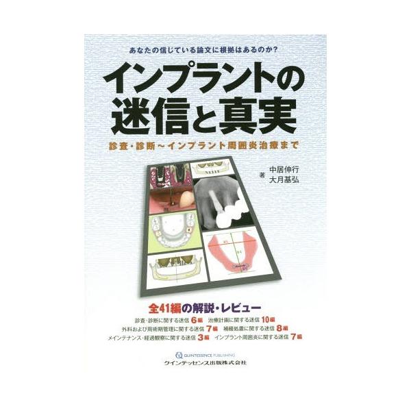 【発売日：2019年06月28日】中居伸行/著 大月基弘/著/インプラントの迷信と真実 診査・診断〜インプラント周囲炎治療まで、メディア：BOOK、発売日：2019/06、重量：536g、商品コード：NEOBK-2369518、JANコード...