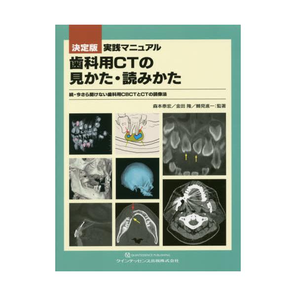 【発売日：2019年09月12日】森本泰宏/監著 金田隆/監著 鱒見進一/監著/実践マニュアル歯科用CTの見かた・読みかた 決定版 今さら聞けない歯科用CBCTとCTの読像法 続、メディア：BOOK、発売日：2019/09、重量：340g、...