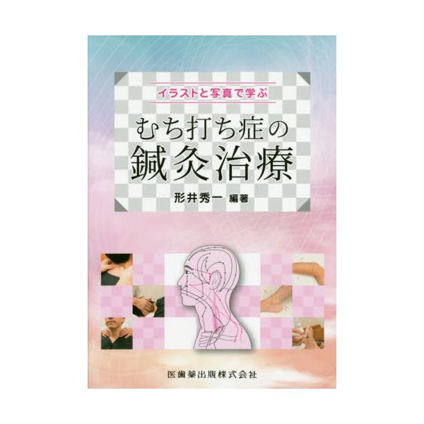 【発売日：2019年09月30日】形井秀一/編著/イラストと写真で学ぶむち打ち症の鍼灸治療、メディア：BOOK、発売日：2019/09、重量：340g、商品コード：NEOBK-2415914、JANコード/ISBNコード：978426324...