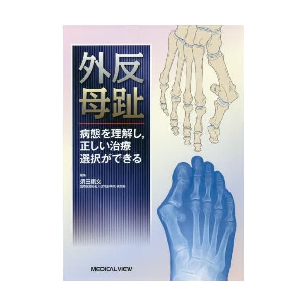 【発売日：2019年11月17日】須田康文/編集/外反母趾 病態を理解し 正しい治療選択ができる、メディア：BOOK、発売日：2019/11、重量：583g、商品コード：NEOBK-2432296、JANコード/ISBNコード：978475...