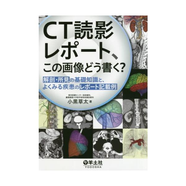 【発売日：2019年11月22日】小黒草太/著/CT読影レポート、この画像どう書く? 解剖・所見の基礎知識と、よくみる疾患のレポート記載例、メディア：BOOK、発売日：2019/11、重量：426g、商品コード：NEOBK-2434477、...
