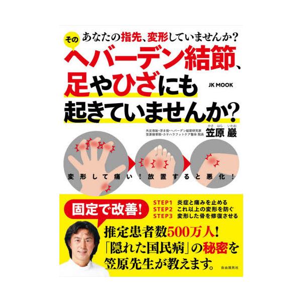 【発売日：2020年07月28日】笠原巖/著/そのヘバーデン結節、足やひざにも起きていませんか?──あなたの指先、変形していませんか? (JK MOOK)、メディア：BOOK、発売日：2020/07、重量：289g、商品コード：NEOBK-...