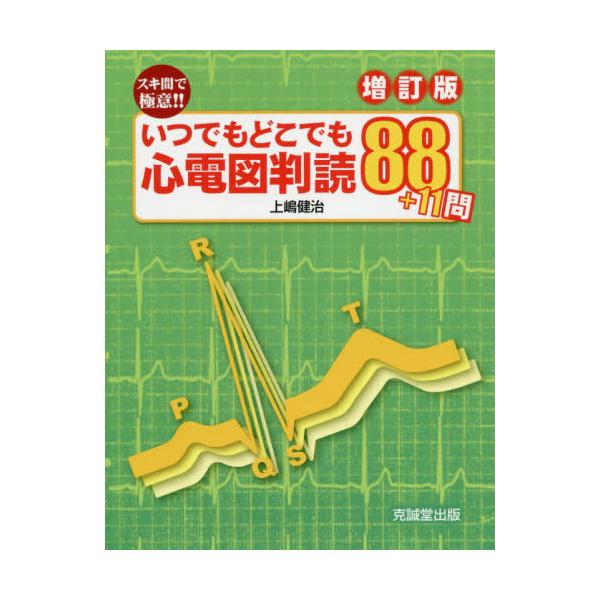 【発売日：2020年07月28日】上嶋健治/著/いつでもどこでも心電図判読88+ 増訂版 (スキ間で極意!!)、メディア：BOOK、発売日：2020/07、重量：340g、商品コード：NEOBK-2517863、JANコード/ISBNコード...
