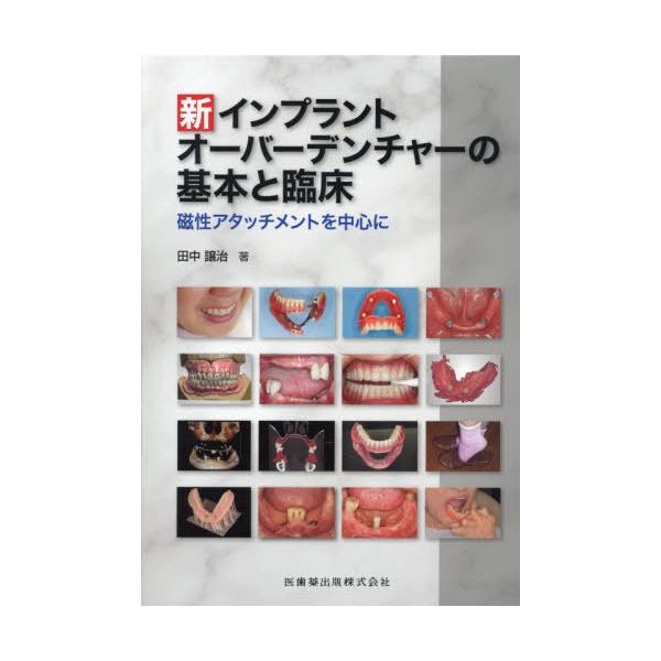 【発売日：2020年09月28日】田中譲治/著/新インプラントオーバーデンチャーの基本と臨床 磁性アタッチメントを中心に、メディア：BOOK、発売日：2020/09、重量：340g、商品コード：NEOBK-2539839、JANコード/IS...