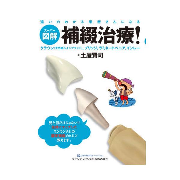 【発売日：2020年10月28日】土屋賢司/著/スーパー図解補綴治療! クラウン〈天然歯&amp;インプラント〉 ブリッジ ラミネートべニア インレー 違いのわかる患者さんになる、メディア：BOOK、発売日：2020/10、重量：742g、...