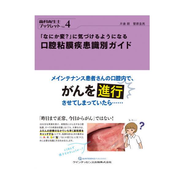 【発売日：2021年02月08日】片倉朗/著 菅原圭亮/著/「なにか変?」に気づけるようになる口腔粘膜疾患識別ガイド (歯科衛生士ブックレット)、メディア：BOOK、発売日：2021/02、重量：340g、商品コード：NEOBK-25815...