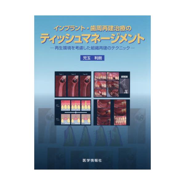 【発売日：2021年03月15日】児玉利朗/著/インプラント・歯周再建治療のティッシュマ、メディア：BOOK、発売日：2021/03、重量：340g、商品コード：NEOBK-2597609、JANコード/ISBNコード：9784903553832
