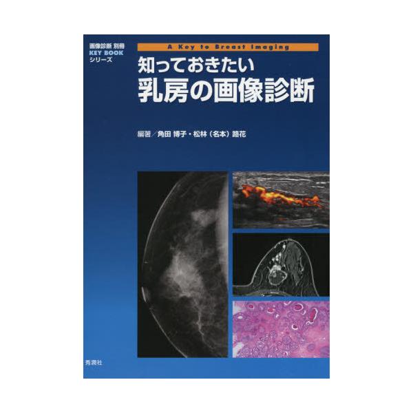 【発売日：2021年03月31日】角田博子/編著 松林(名本)路花/編著/知っておきたい乳房の画像診断 (画像診断別冊KEY)、メディア：BOOK、発売日：2021/03、重量：340g、商品コード：NEOBK-2602582、JANコード...