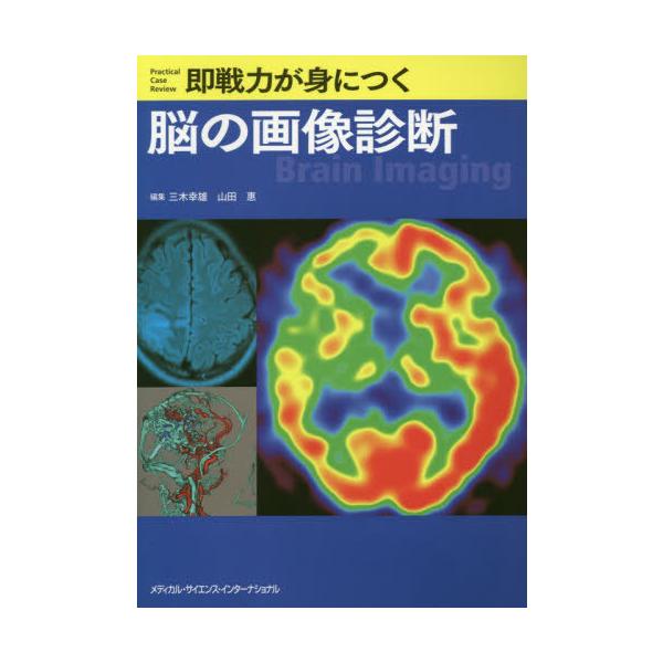 【発売日：2021年04月19日】三木幸雄/編集 山田惠/編集/即戦力が身につく脳の画像診断、メディア：BOOK、発売日：2021/04、重量：340g、商品コード：NEOBK-2610982、JANコード/ISBNコード：97848157...