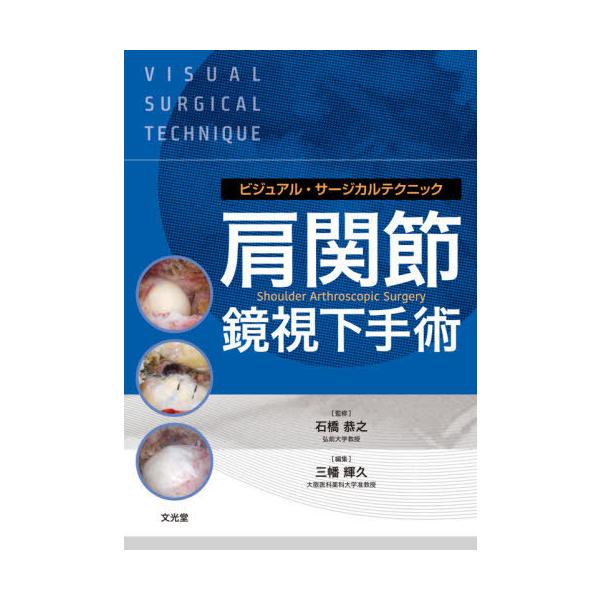【発売日：2021年05月22日】石橋恭之/監修 三幡輝久/編集 二村昭元/〔ほか〕執筆/肩関節鏡視下手術 (ビジュアル・サージカルテクニック)、メディア：BOOK、発売日：2021/05、重量：340g、商品コード：NEOBK-26208...