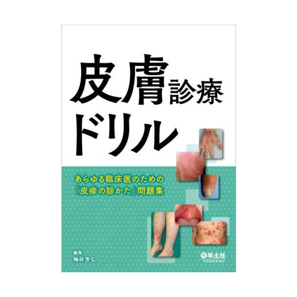 【発売日：2021年10月01日】梅林芳弘/編集/皮膚診療ドリル あらゆる臨床医のための「皮疹の診かた」問題集、メディア：BOOK、発売日：2021/10、重量：340g、商品コード：NEOBK-2663527、JANコード/ISBNコード...