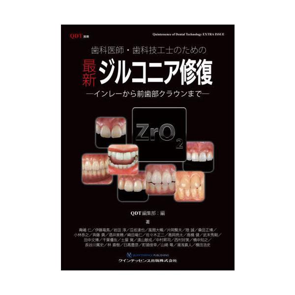 【発売日：2021年11月28日】QDT編集部/編 青嶋仁/〔ほか〕著/歯科医師・歯科技工士のための最新ジルコニア修復 インレーから前歯部クラウンまで、メディア：BOOK、発売日：2021/11、重量：726g、商品コード：NEOBK-26...