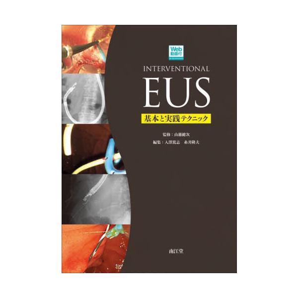 【発売日：2021年11月11日】山雄健次/監修 入澤篤志/編集 糸井隆夫/編集 山雄健次/〔ほか〕執筆/INTERVENTIONAL EUS 基本と実践テクニック Web動画付、メディア：BOOK、発売日：2021/11、重量：340g、...