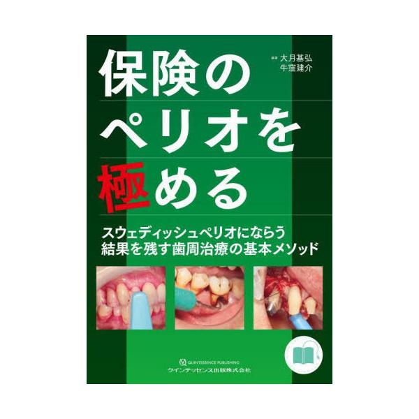 【発売日：2021年12月07日】大月基弘/編著 牛窪建介/編著/保険のペリオを極める スウェディッシュペリオにならう結果を残す歯周治療の基本メソッド (QUINT KICK-OFF LIBRARY)、メディア：BOOK、発売日：2021/...