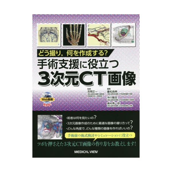 【発売日：2021年12月25日】吉岡正一/監修 重松良典/編集 沖川隆志/編集 奥村秀一郎/編集/どう撮り 何を作成する?手術支援に役立つ3次元CT画像、メディア：BOOK、発売日：2021/12、重量：340g、商品コード：NEOBK-...