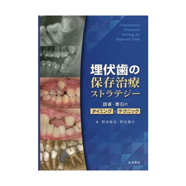 【発売日：2021年09月28日】野田隆夫/著 野田雅代/著/埋伏歯の保存治療ストラテジー、メディア：BOOK、発売日：2021/09、重量：377g、商品コード：NEOBK-2694429、JANコード/ISBNコード：978481601...