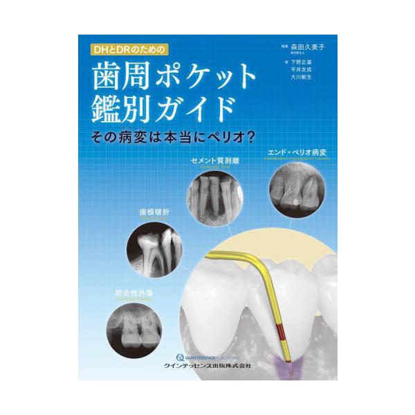 【発売日：2022年01月28日】森田久美子/編著 下野正基/著 平井友成/著 大川敏生/著/DHとDRのための歯周ポケット鑑別ガイド その病変は本当にペリオ?、メディア：BOOK、発売日：2022/01、重量：465g、商品コード：NEO...