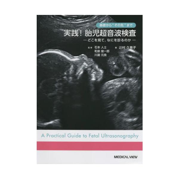 【発売日：2022年02月28日】辻村久美子/著 石本人士/監修 和泉俊一郎/監修 川瀧元良/監修/基礎から“その先”まで実践!胎児超音波検査 どこを見て なにを診るのか、メディア：BOOK、発売日：2022/02、重量：340g、商品コー...