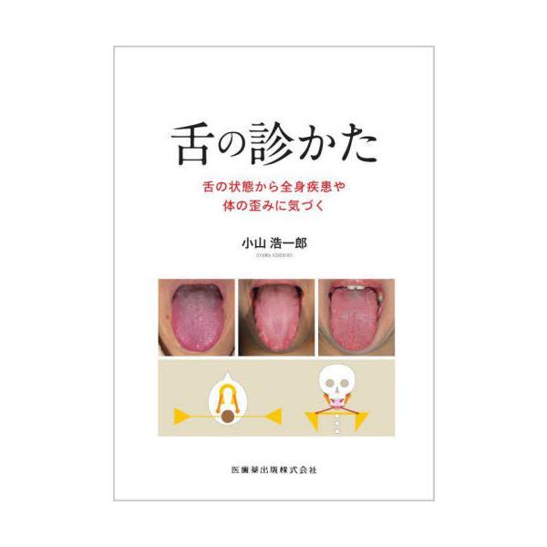 【発売日：2022年03月01日】小山浩一郎/著/舌の診かた、メディア：BOOK、発売日：2022/03、重量：531g、商品コード：NEOBK-2715064、JANコード/ISBNコード：9784263446546
