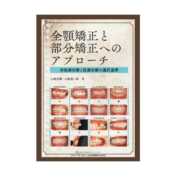 【発売日：2022年05月28日】山地正樹/著 山地晃二郎/著/全顎矯正と部分矯正へのアプローチ 非抜歯治療と抜歯治療の選択基準、メディア：BOOK、発売日：2022/05、重量：340g、商品コード：NEOBK-2737884、JANコー...